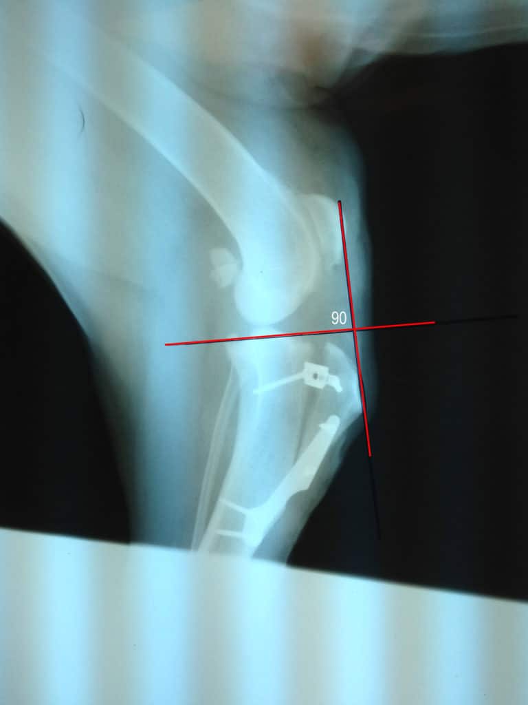Tibial Tuberosity Advancement Surgery (TTA Surgery)